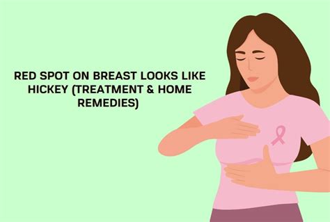 Red Spots On Breast Breastfeeding At Jai Denison Blog