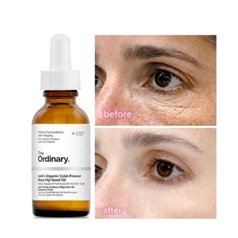 The Ordinary Caffeine Solution 5 Egcg 30ml