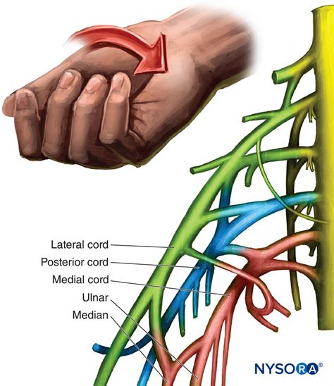 Infraclavicular Brachial Plexus Block Landmarks And Nerve Stimulator Technique Nysora Nysora