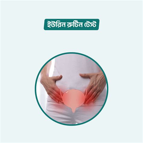 Urine Routine Examination Urine Re Arogga Online Lab