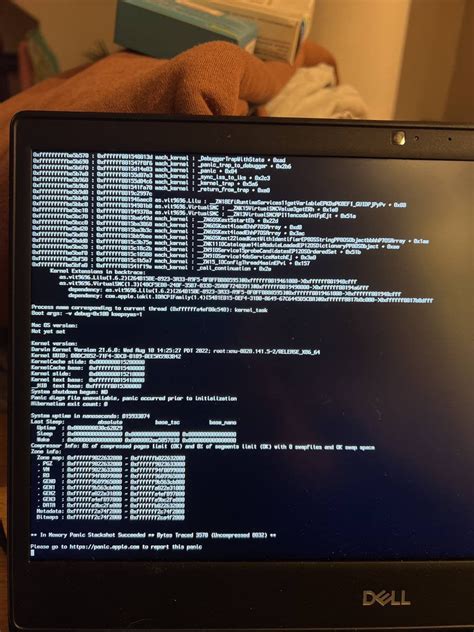 can anyone r hackintosh