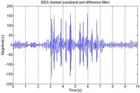 Eeg Signal After Pass Band Filter 10 25 Hz Download Scientific Diagram Eeg Signal After Pass Band Filter 10 25 Hz Download Scientific Diagram