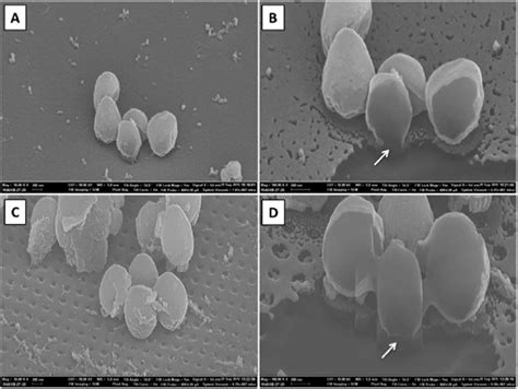 Sem Fib Imaging And Milling Of The S Aureus Pc Interface Imaging Of