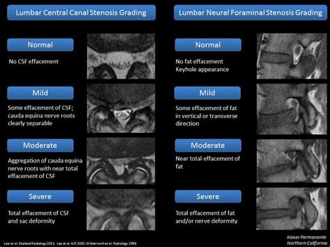 Pin On Neuroradiology