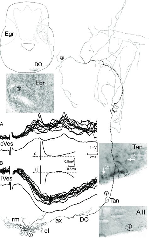 Vestibular Input And Camera Lucida Drawing Of An Area Ii Neuron With An