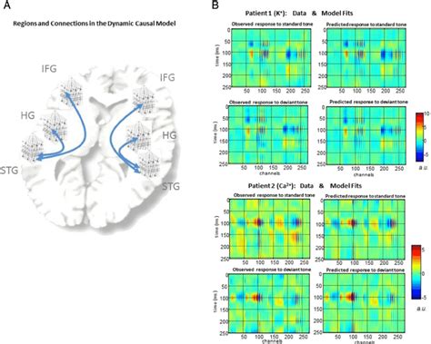 Optimized Dynamic Causal Models A The Event Related Fi Elds Were
