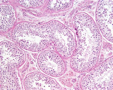 File Testis Histology 010  Embryology