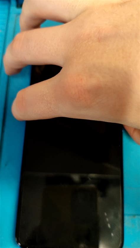 Redmi Note 11 Strange Behaviour Rxiaomi