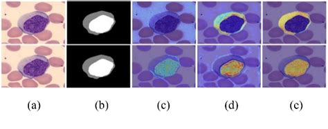 Figure 1 From Deep Features Aggregation Based Joint Segmentation Of Cytoplasm And Nuclei In