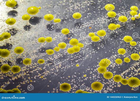 Bacteria Grown From Skin Smear Colonies Of Micrococcus Luteus And Staphylococcus Epidermidis