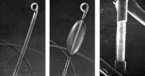 Mapping And Ablation Of Ventricular Tachycardia With The Aid Of A Non Contact Mapping System Heart