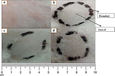 Skin Irritation Test Of The Topical Hydrogel Patch Download Scientific Diagram