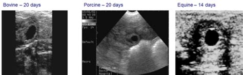 Pregnancy Diagnosis Flashcards Quizlet