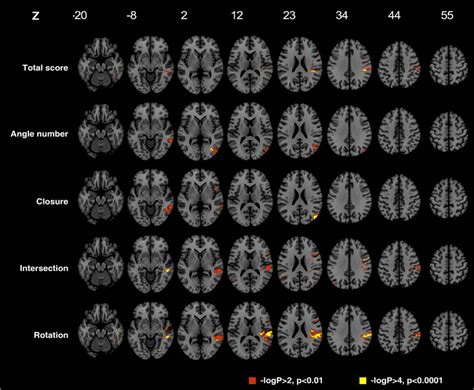 results of voxelwise support vector regression lesion symptom mapping