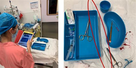 Hkust Launches Ai Based Guidewire Recognition Technology To Enhance Patient Safety Hkust