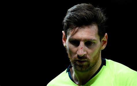 Dihantam Smalling Messi Alami Cedera Serius Medcomid