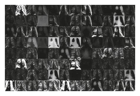 Learned Filters A Convolution Layer 1 And B Pooling Layer 1