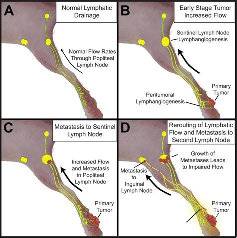 Mouse Inguinal Lymph Nodes