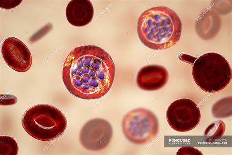 Plasmodium Vivax Protozoa And Red Blood Cells Digital Illustration