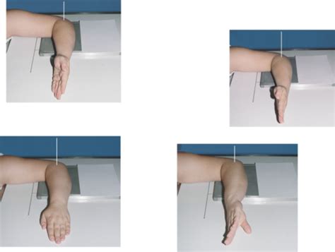 X Ray Elbow Position