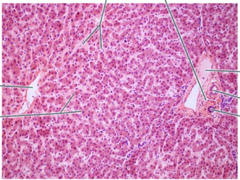 Liver Portal Triad Histology Liver Gallbladder The Normal Liver And