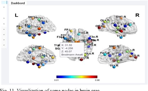 Figure 11 From A Multimodal Fusion Depression Recognition Assisted Decision Making System Based