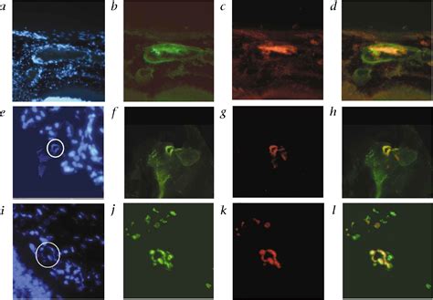 Retinal Ischemia Semantic Scholar