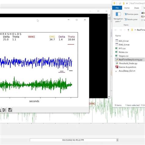 Graphic Interface Of Eeg And Emg Recordings Eeg And Emg Signals Are