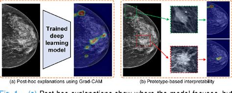 Figure 1 From An Interpretable And Accurate Deep Learning Diagnosis