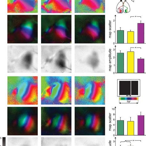 Visual Acuity Differences Between Left And Right Eyes Of Individual