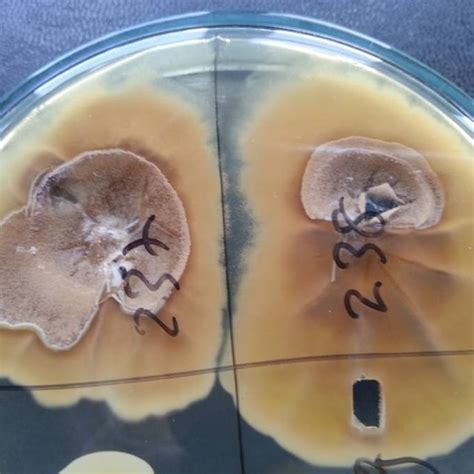 Cryptococcus Neoformans Sabouraud Dextrose Agar 25°c 5 Days Surface
