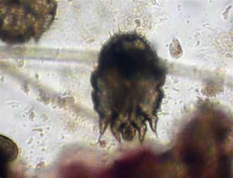 Scabies Mite Life Cycle