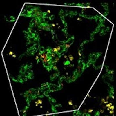 Nanostring Releases First Cosmx Smi Dataset