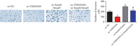 Tmem100 Suppresses Crc Cell Growth By Regulating Tgf β Signaling