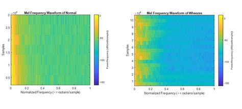 b mel frequency cepstrum coefficients of input signal download