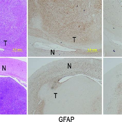 C Myc Promotes Tumor Cell Proliferation With Inhibition Of Cell Download Scientific Diagram