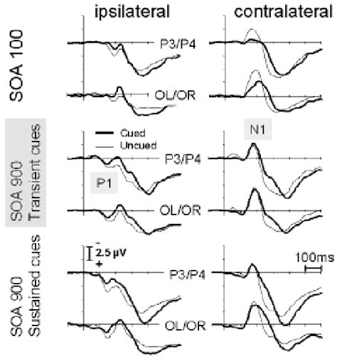 Event Related Eeg Potentials At Posterior Electrode Sites As Measured Download Scientific