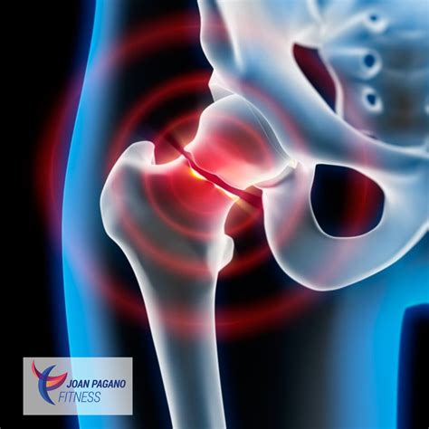 Osteopenia Vs Normal