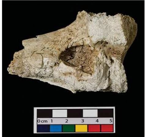 A Defect In The Popliteal Fossa On The Back Of A Femur The
