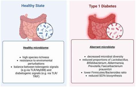 Full Article Gut Microbiome In Type 1 Diabetes The Immunological