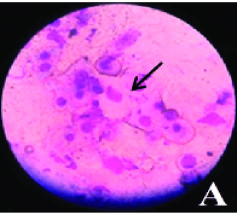 The Cytological Features Of The Proestrus Phase Are Characterized By