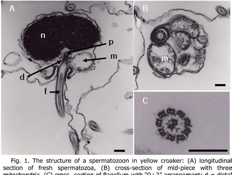 Figure 1 From Semen Properties And Spermatozoan Structure Of Yellow