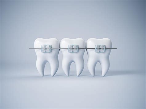 Premium Photo Teeth With Or Without Braces Arch Braces Without Teeth