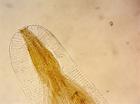 Pathology Outlines Enterobius Vermicularis