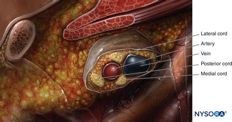 Anatomía Del Plexo Braquial Simplificada Plexo Braquial Danna