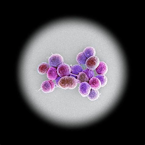Streptococcus Faecalis Under Microscope