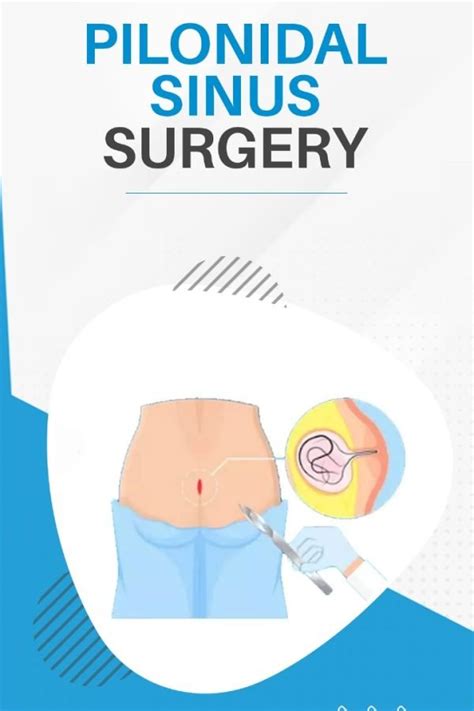 Pilonidal Sinus Surgery Dr Rahul Mahadar