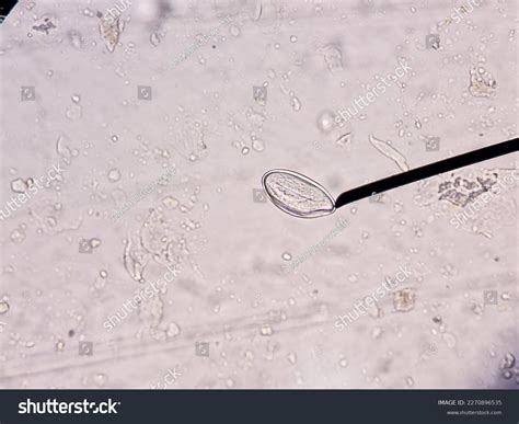 Pinworm Under Microscope