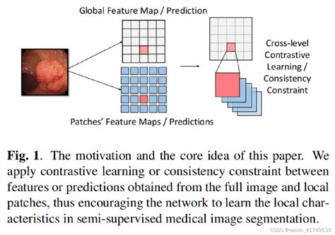 cross level contrastive learning and consistency constraint for medical