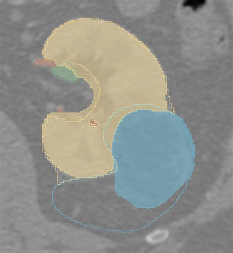 Example Fault Segmentation For The 32 Case Individual Contours Denote Download Scientific